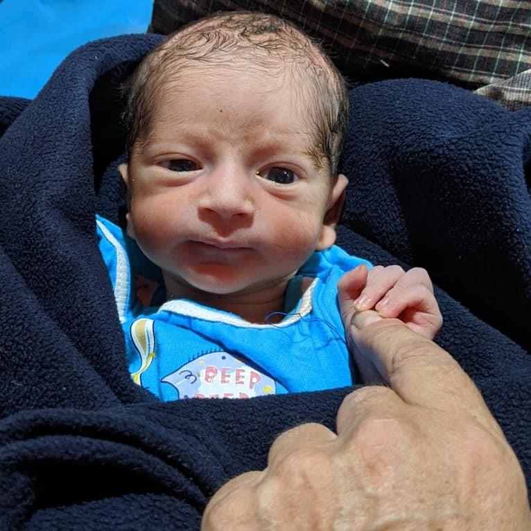 34 week posterior breech with cord prolapse and cervical head entrapment