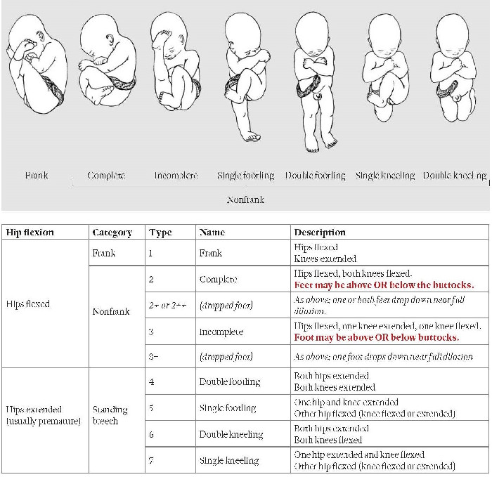 Breech nomenclature chart